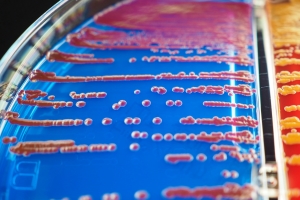 U2Gene Service by U2Bio